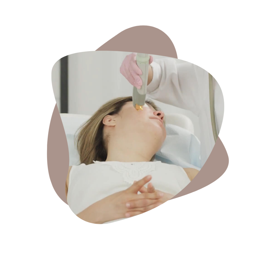 Long Pulse Laser - Aesthetic Treatment Clinic Singapore | VIDASKIN ...