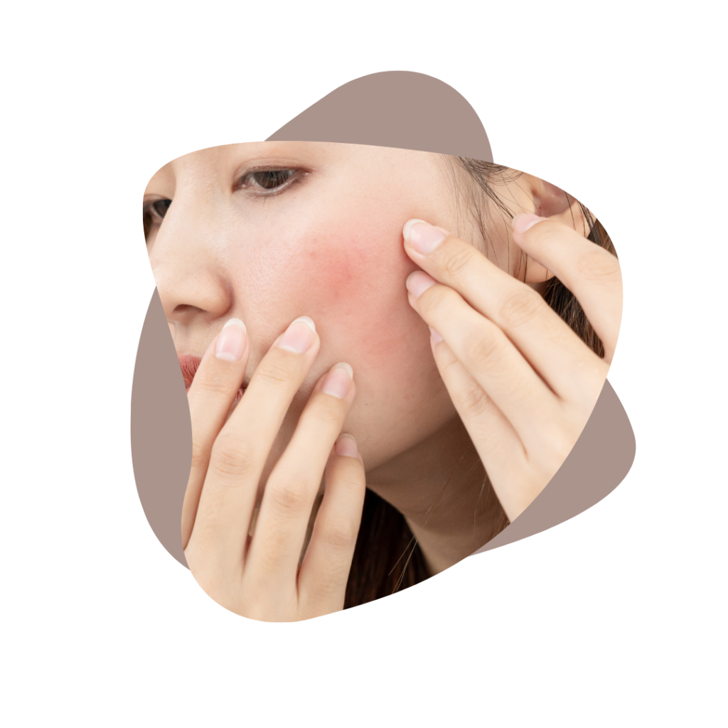 Long Pulse Laser - VIDASKIN Medical Aesthetic Clinic