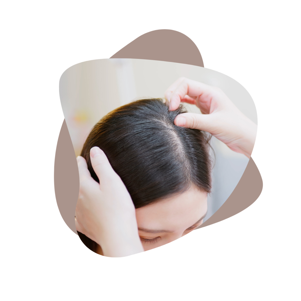 Hair Loss Treatment In Singapore Guide And Treatments Available