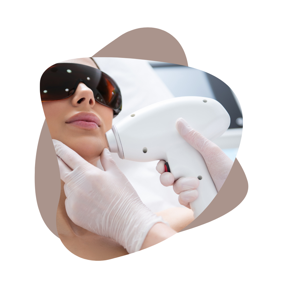 Freckles - VIDASKIN Medical Aesthetic Clinic